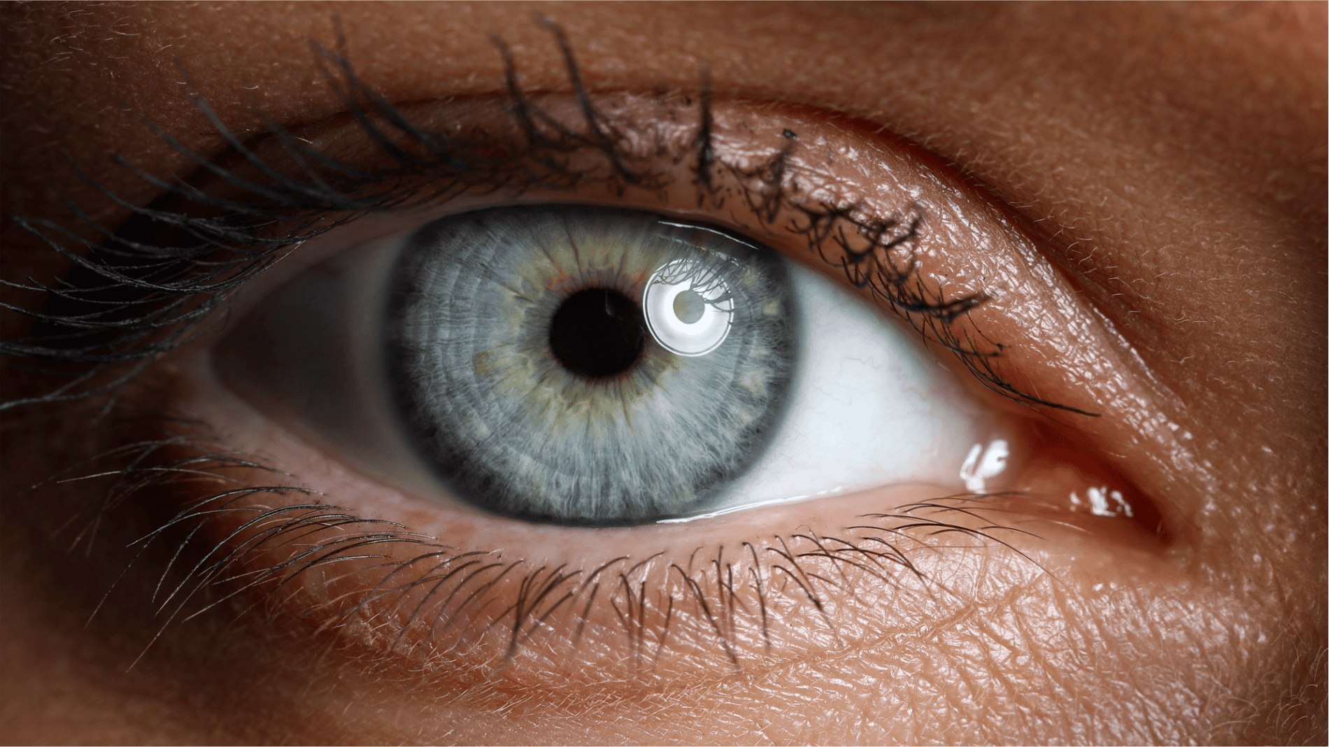 Eye Treatments in Turkey